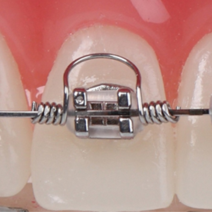 WARREN TRQ SPRINGS 016 X 022